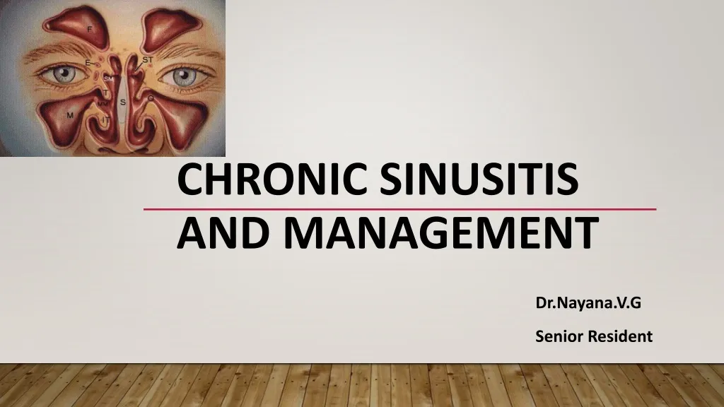 PPT - Chronic sinusitis and management PowerPoint Presentation, free download - ID:1010163