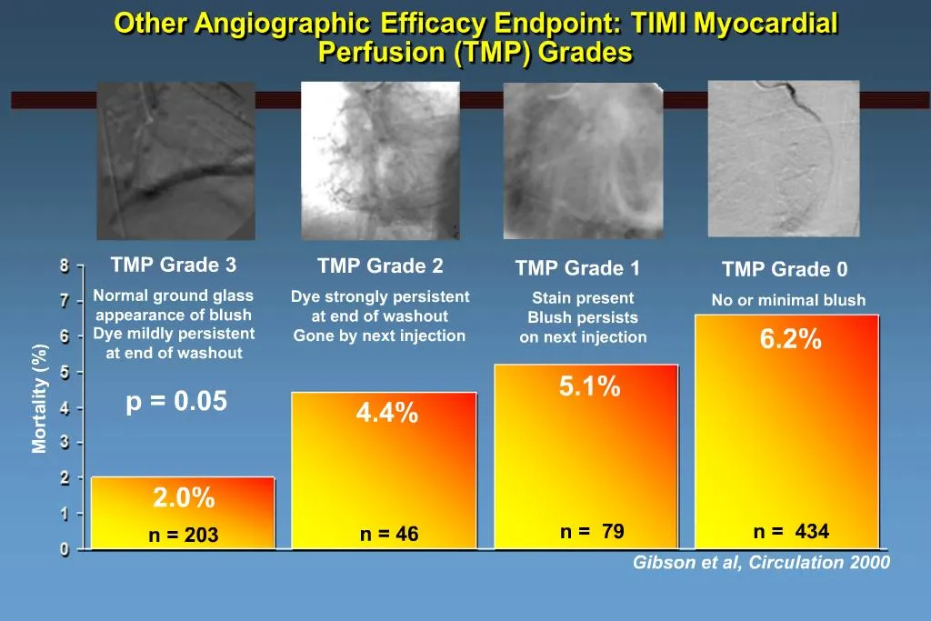 PPT - Other Angiographic Efficacy Endpoint: TIMI Myocardial Perfusion ...