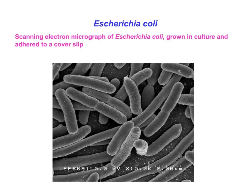 PPT - Escherichia coli PowerPoint Presentation, free download - ID:1048675