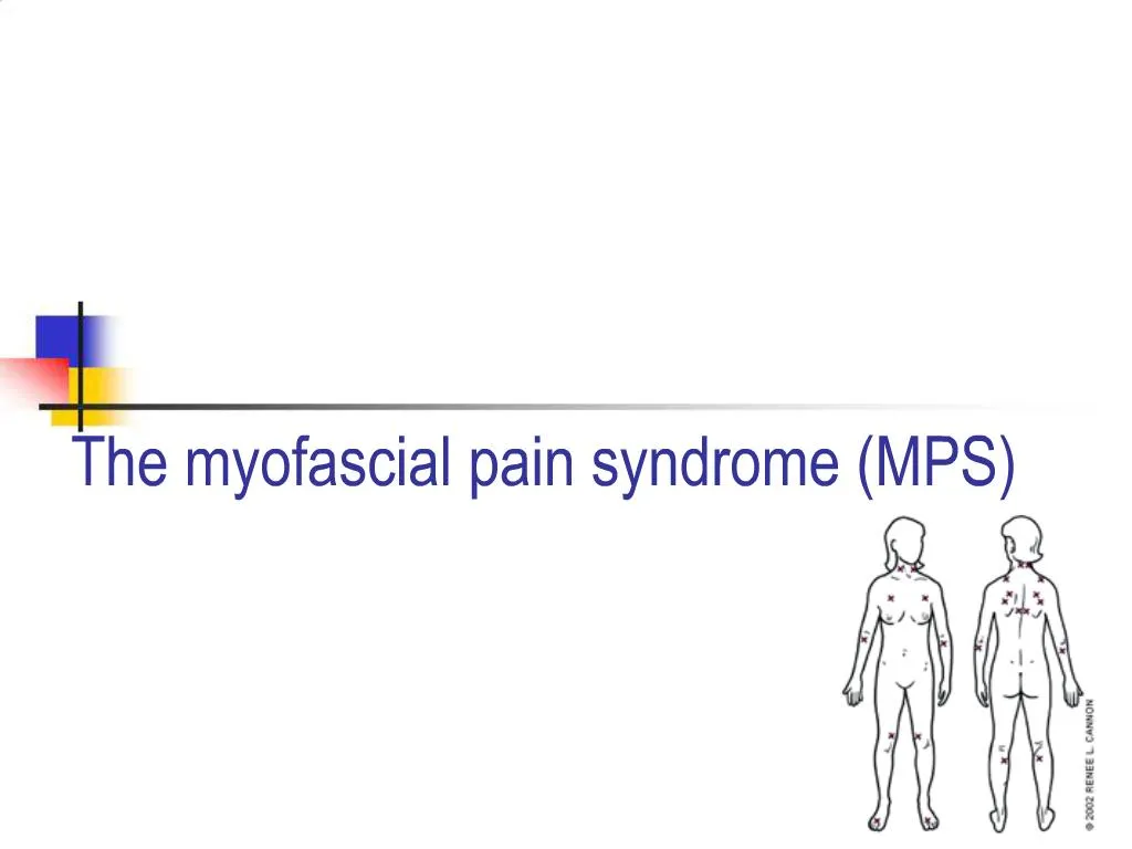 PPT - The myofascial pain syndrome MPS PowerPoint Presentation, free ...