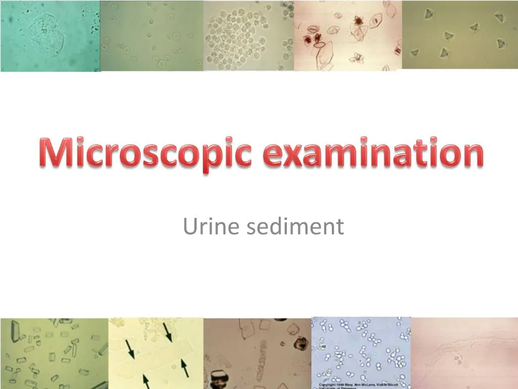 PPT - Urine sediment PowerPoint Presentation, free download - ID:1143449