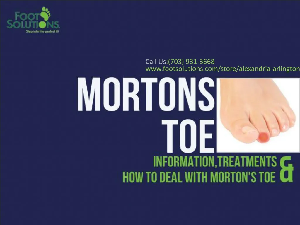PPT - How To Deal With Morton Toes PowerPoint Presentation, free ...