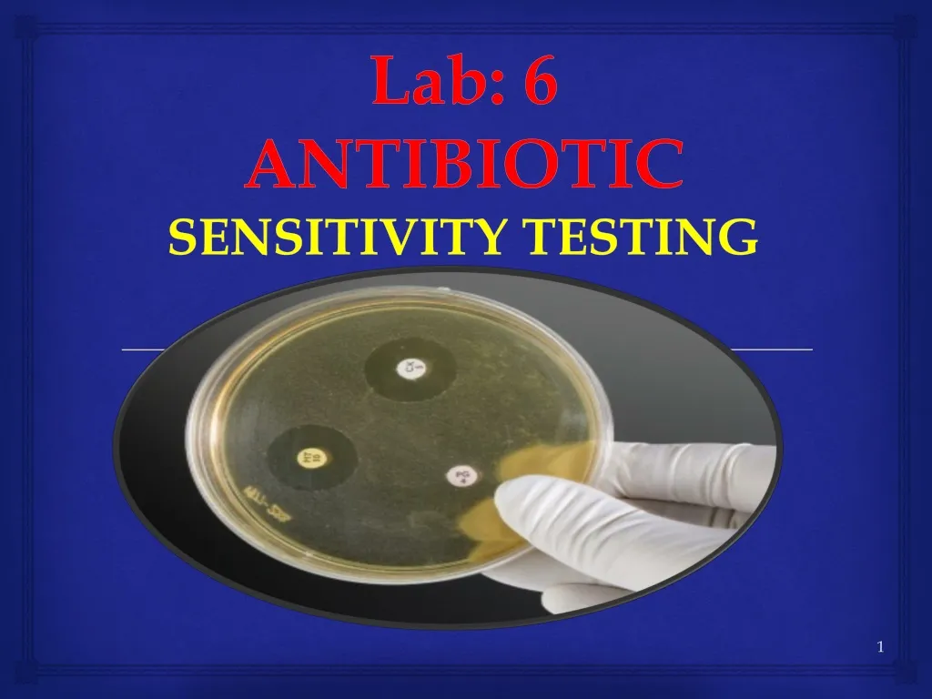 PPT - Lab: 6 ANTIBIOTIC SENSITIVITY TESTING PowerPoint Presentation ...