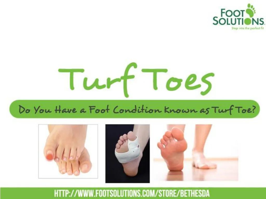 PPT - Know Everything About Turf Toes PowerPoint Presentation, free ...