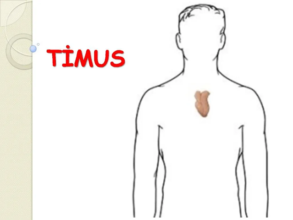 PPT - TIMUS PowerPoint Presentation, free download - ID:1422175