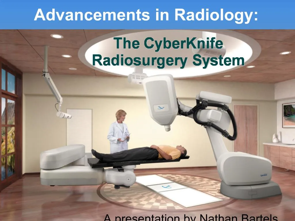 PPT - Advancements in Radiology: PowerPoint Presentation, free download ...