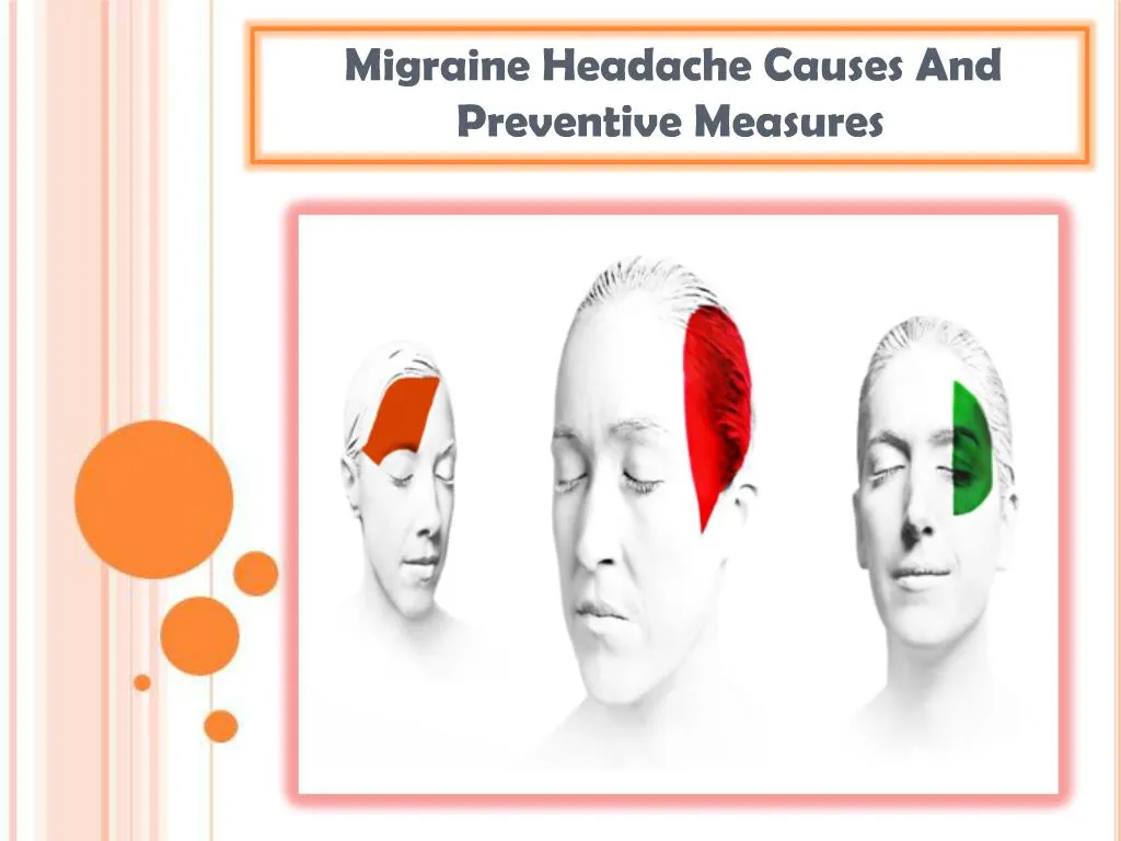 PPT - Migraine Headache Causes And Preventive Measures PowerPoint ...