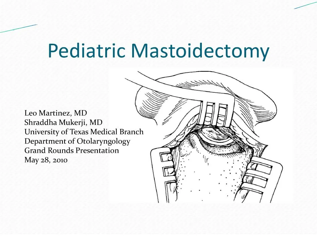 PPT - pediatric mastoidectomy PowerPoint Presentation, free download ...