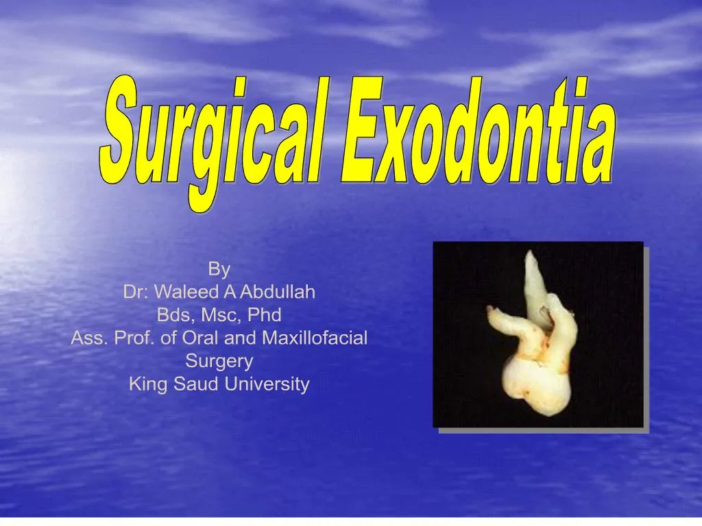 PPT - Surgical Exodontia PowerPoint Presentation, free download - ID:209221