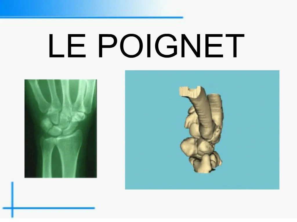 PPT - ANATOMIE DU POIGNET PowerPoint Presentation, free download - ID ...