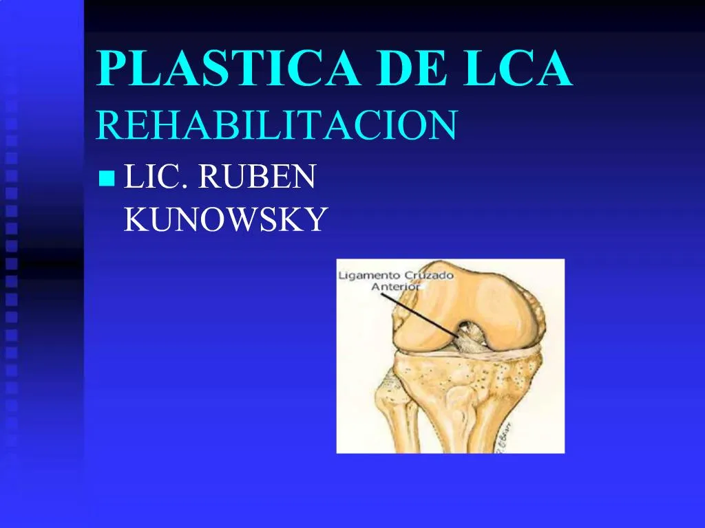 PPT - PLASTICA DE LCA REHABILITACION PowerPoint Presentation, free ...