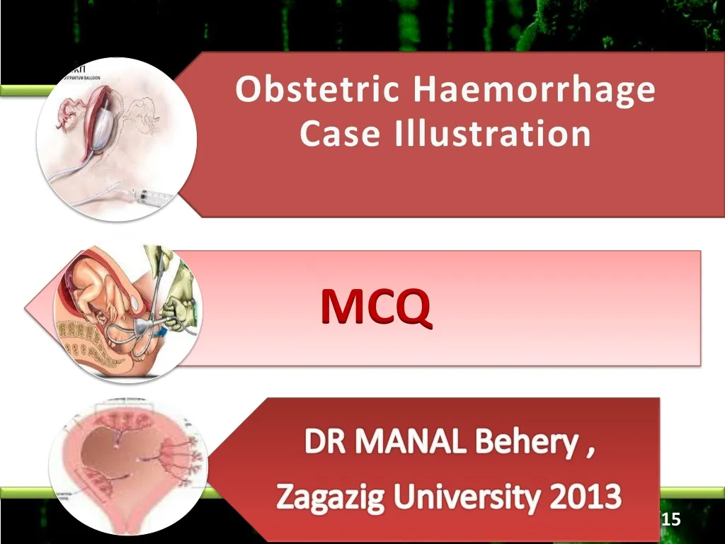 PPT - CASE 1 : Third Trimester Bleeding PowerPoint Presentation, free ...
