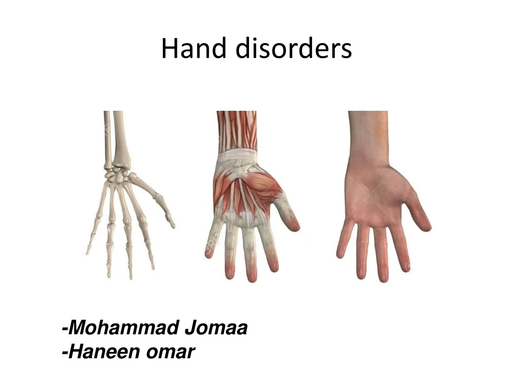 PPT - Hand disorders PowerPoint Presentation, free download - ID:273638