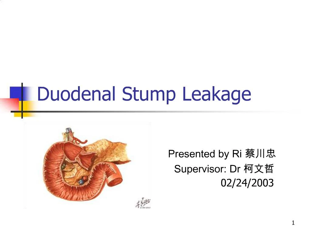 PPT - Duodenal Stump Leakage PowerPoint Presentation, free download ...