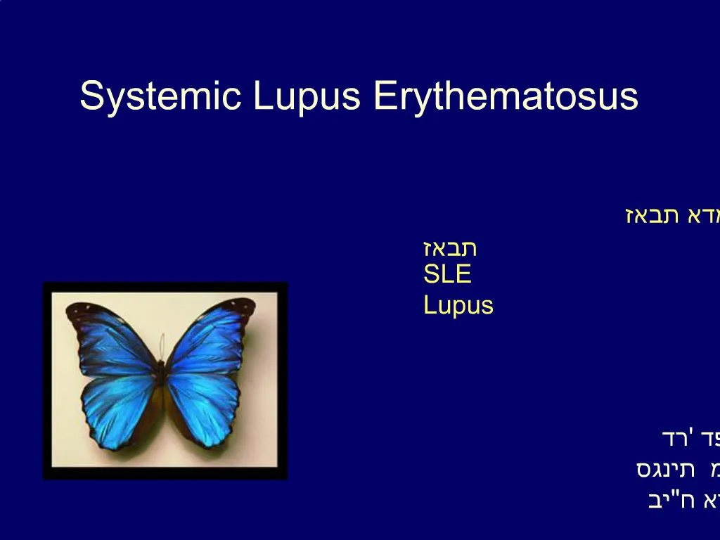 PPT - Systemic Lupus Erythematosus PowerPoint Presentation, free ...