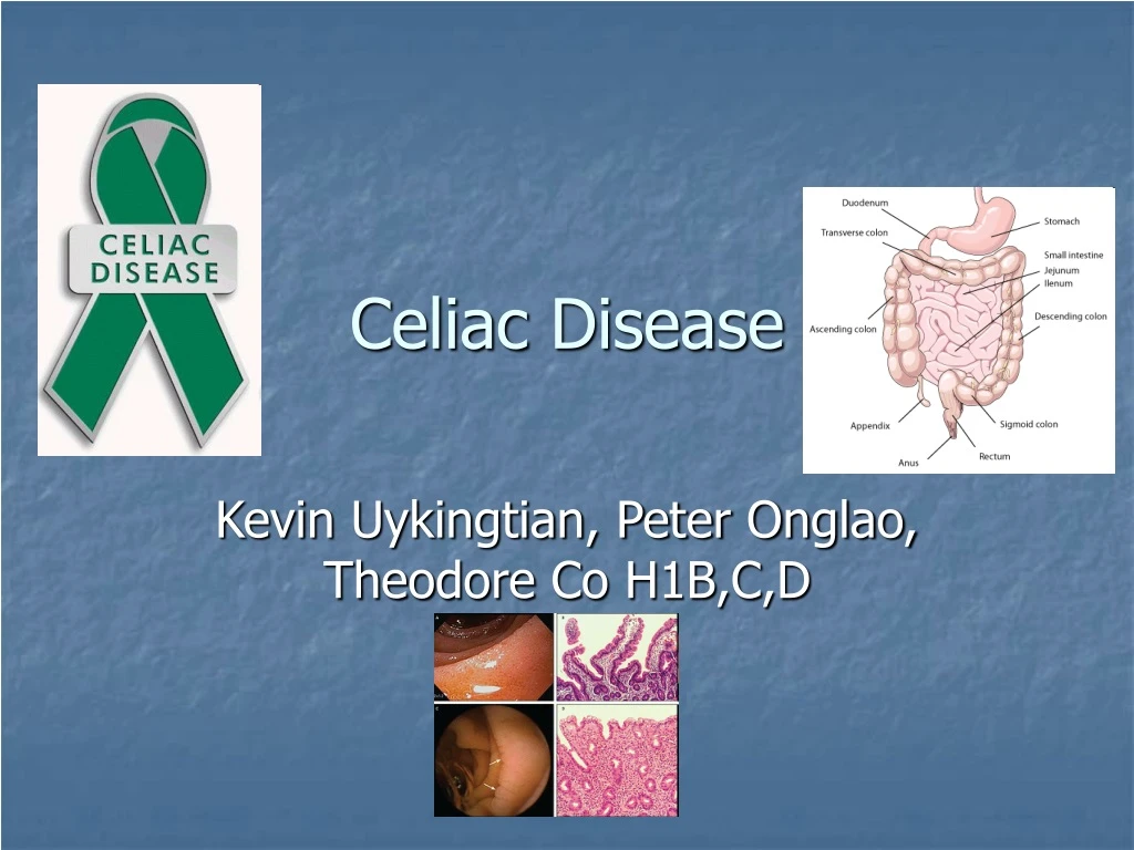 PPT - Celiac Disease PowerPoint Presentation, free download - ID:355786