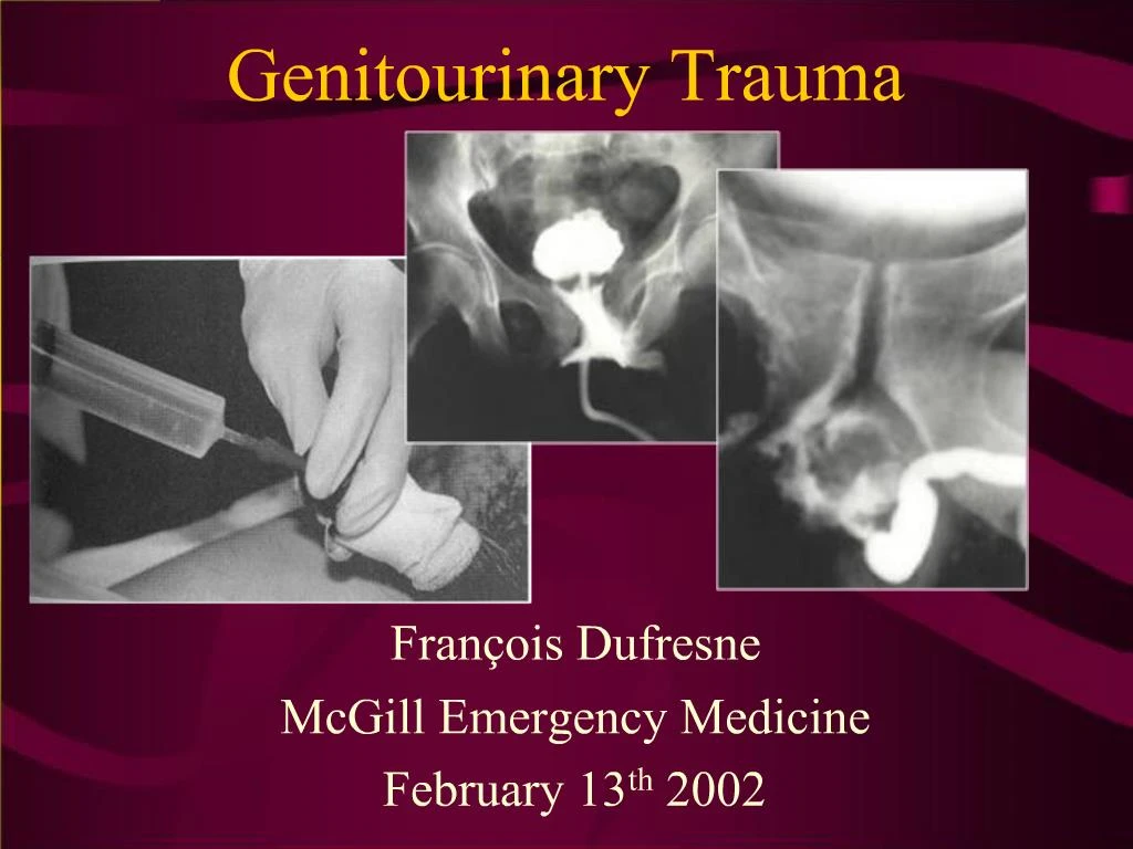 PPT - Genitourinary Trauma PowerPoint Presentation, free download - ID ...