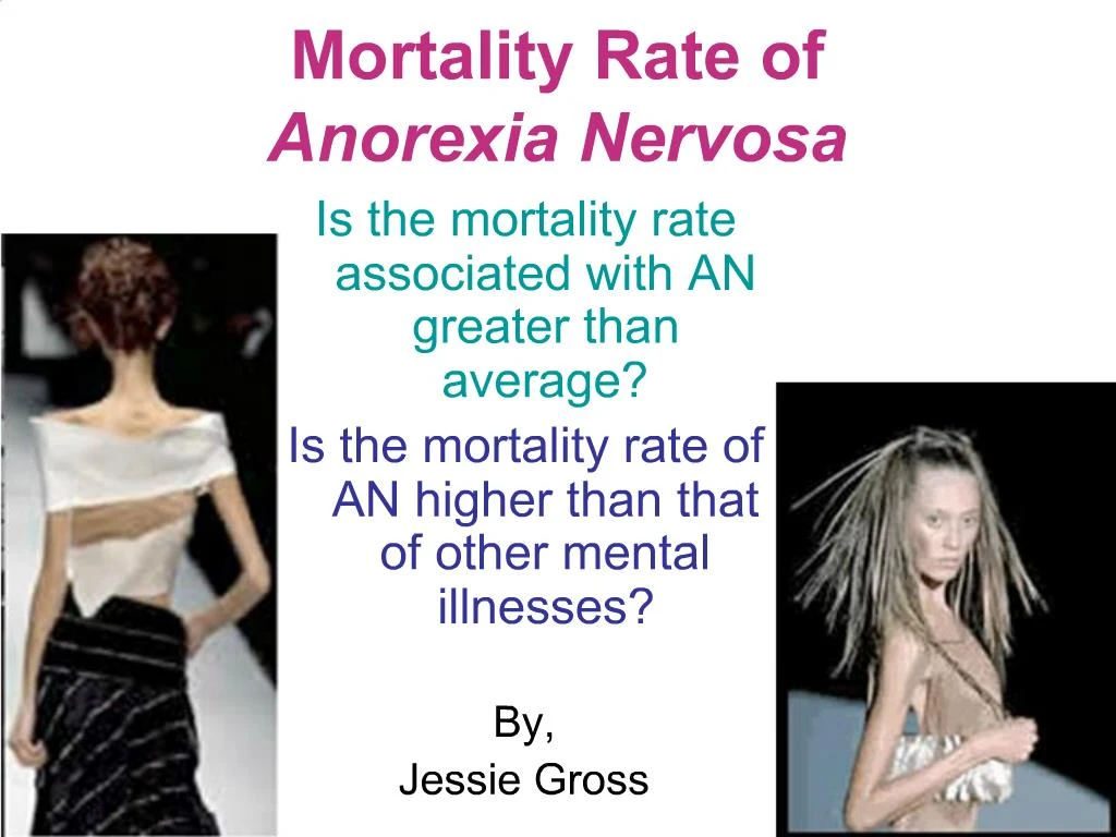 PPT - Mortality Rate of Anorexia Nervosa PowerPoint Presentation, free ...