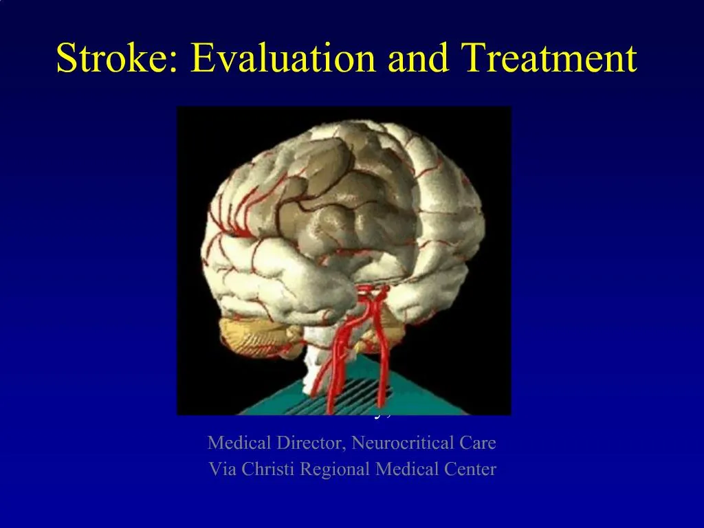 PPT - Stroke: Evaluation and Treatment PowerPoint Presentation, free ...