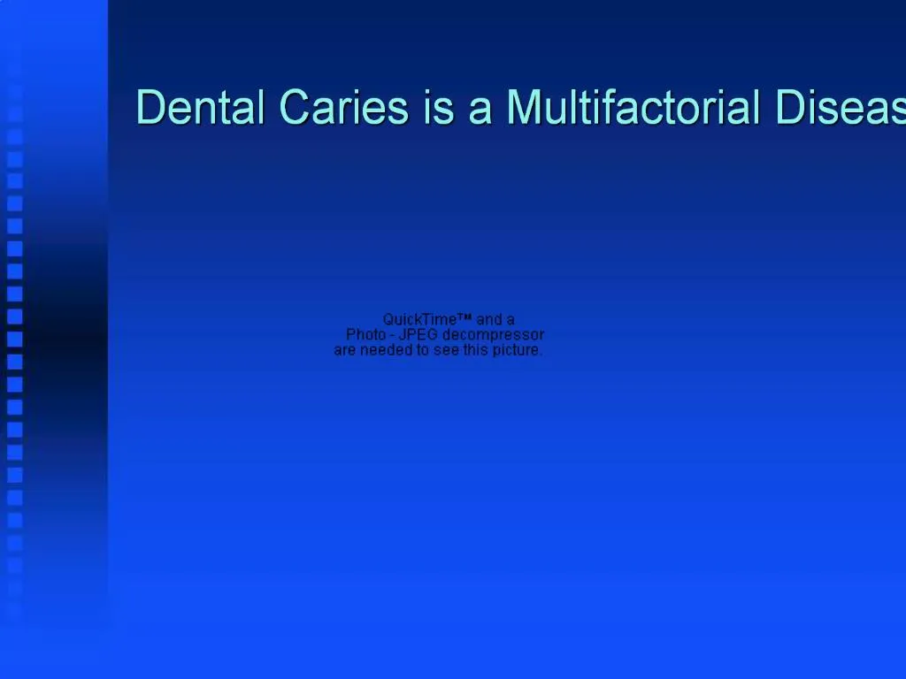 PPT - Dental Caries is a Multifactorial Disease PowerPoint Presentation ...