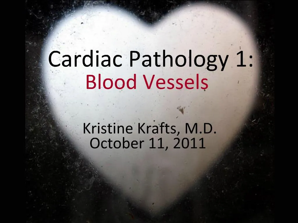 PPT - Cardiac Pathology 1: PowerPoint Presentation, free download - ID ...