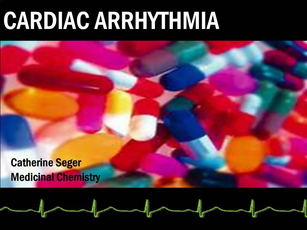 PPT - CARDIAC ARRHYTHMIA PowerPoint Presentation, free download - ID:503454