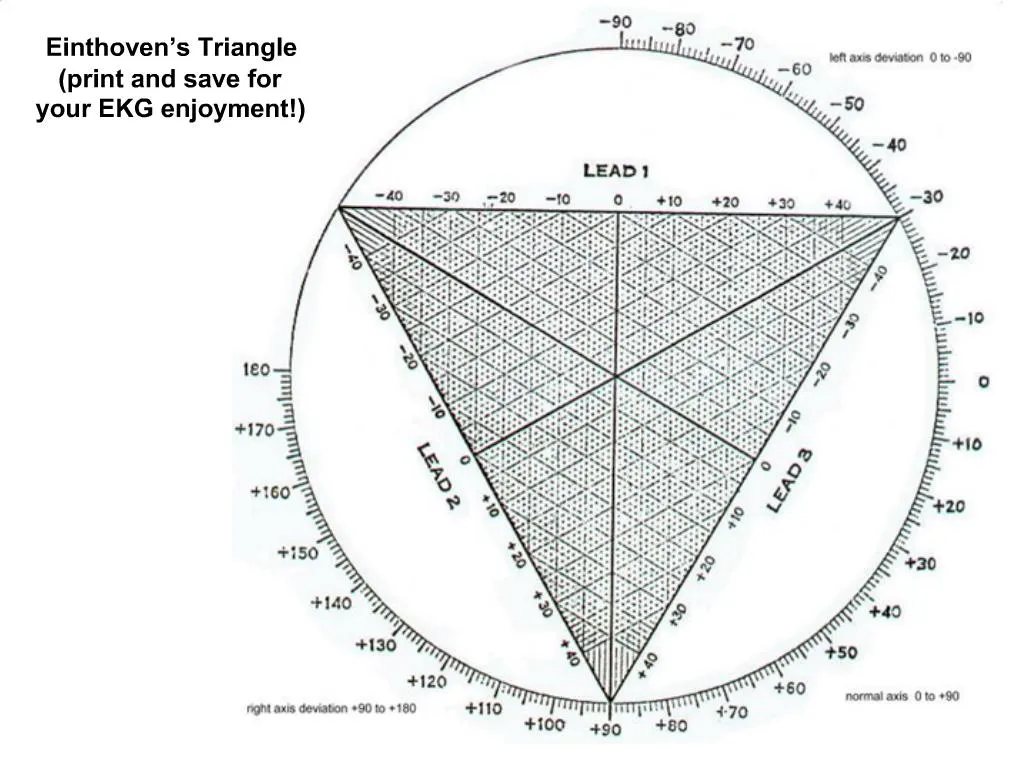 PPT - Einthoven s Triangle print and save for your EKG enjoyment ...