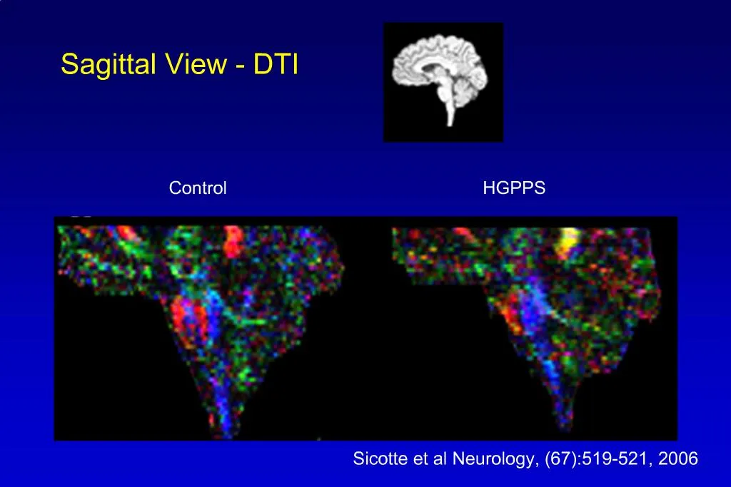 PPT - Sagittal View - DTI PowerPoint Presentation, free download - ID ...