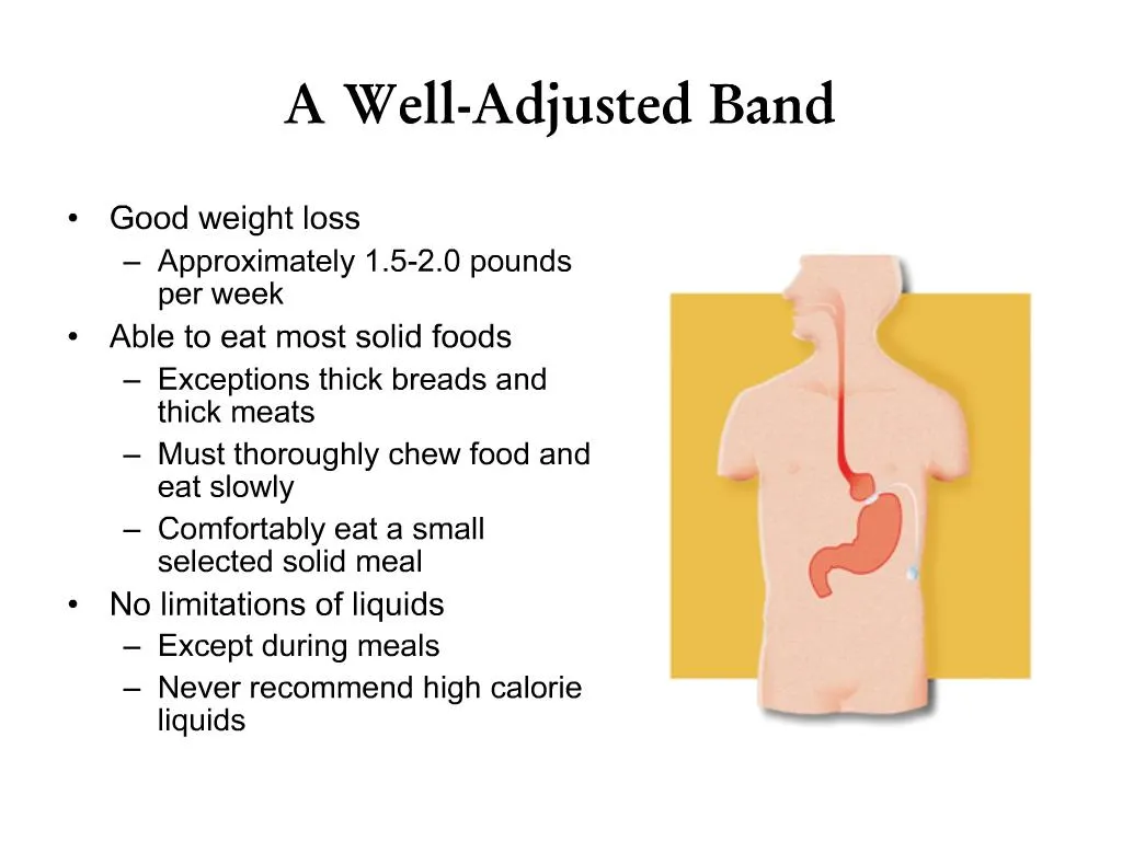 PPT - A Well-Adjusted Band PowerPoint Presentation, free download - ID ...