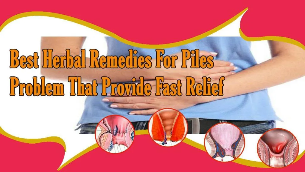 PPT - Best Herbal Remedies For Piles Problem That Provide Fast ...