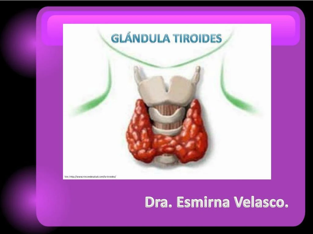 PPT - PRESENTACÓN TIROIDES PowerPoint Presentation, free download - ID ...