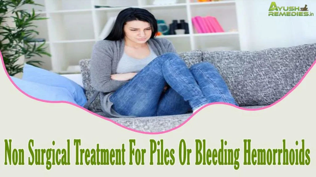 PPT - Non Surgical Treatment For Piles Or Bleeding Hemorrhoids ...