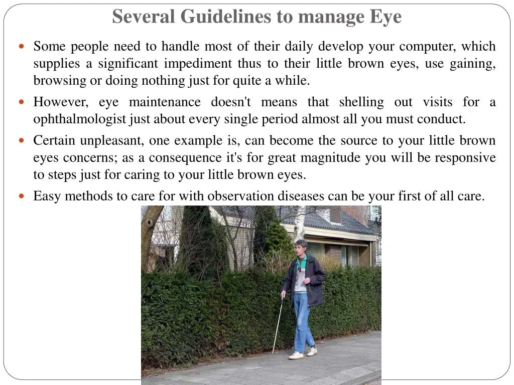 PPT - Several Guidelines to manage eye PowerPoint Presentation, free ...