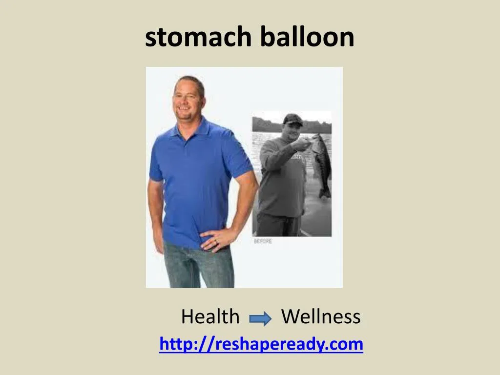 PPT - bariatric balloon weight loss PowerPoint Presentation, free ...