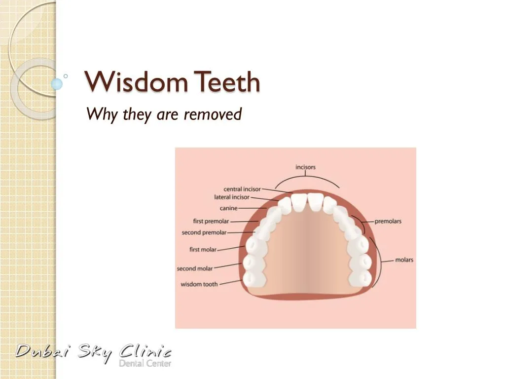 PPT - Wisdom Teeth PowerPoint Presentation, free download - ID:7246787