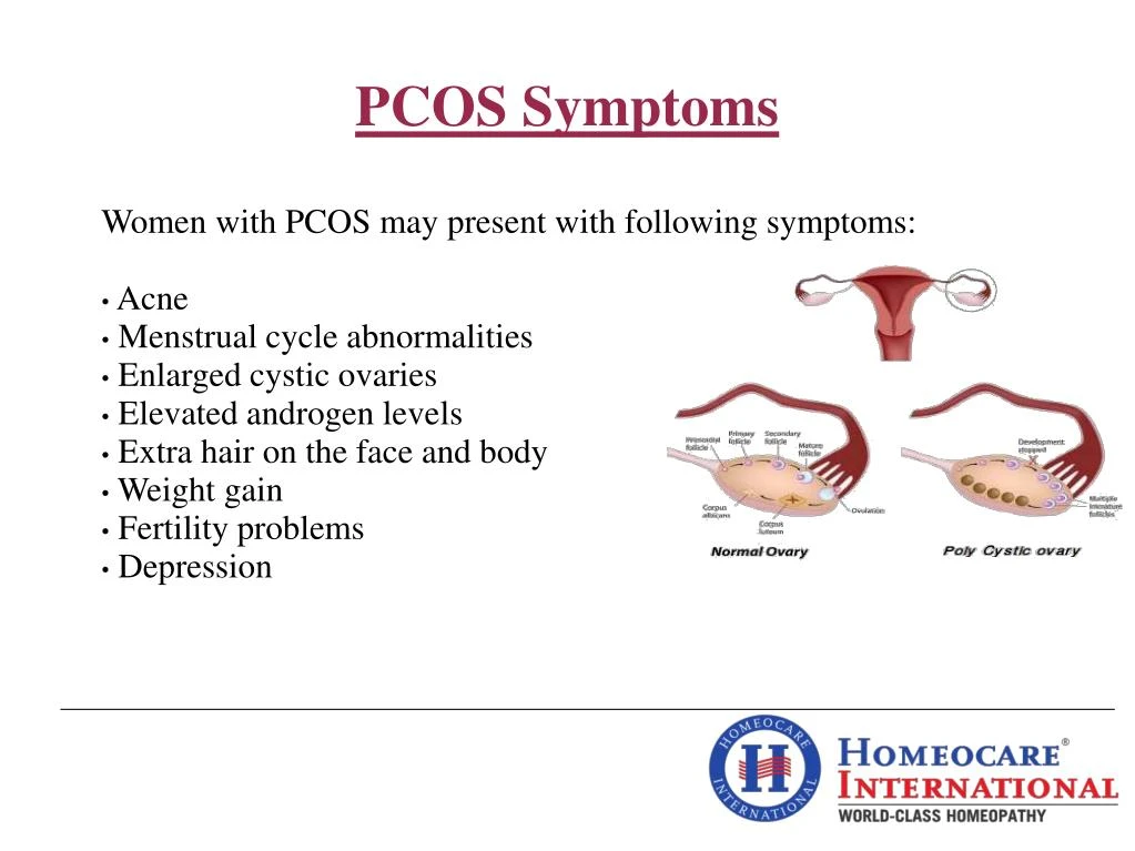 PPT - PCOS Treatment | Homeocare International PowerPoint Presentation ...