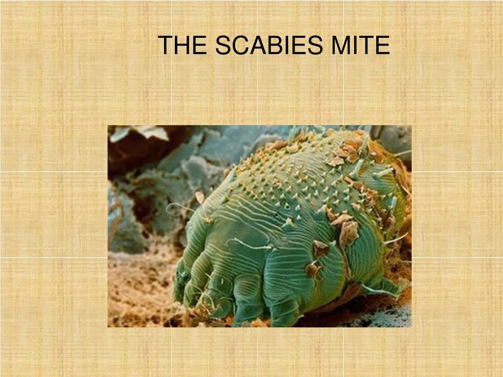 PPT - Scabies Life cycle, Diagnosis & Treatment PowerPoint Presentation ...