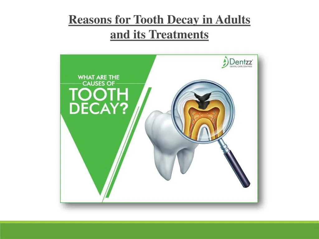 PPT - Reasons for tooth decay in adults and its treatments PowerPoint ...