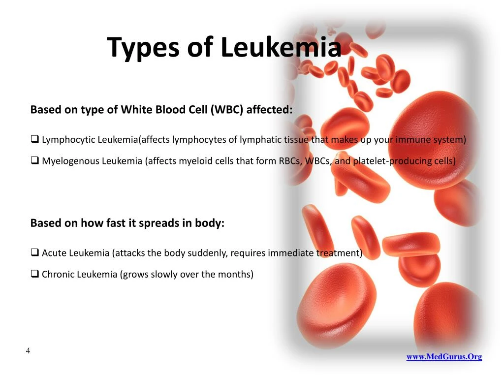 Ppt Understanding Leukemia Powerpoint Presentation Id 7317190
