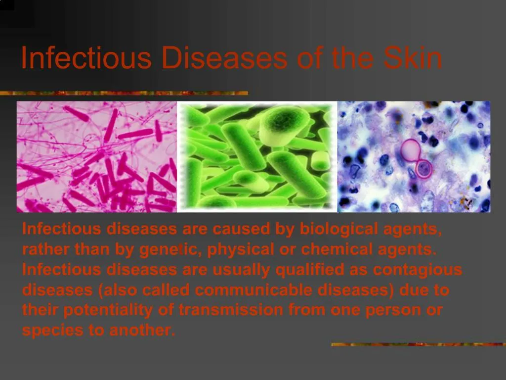 PPT - Infectious Diseases of the Skin PowerPoint Presentation, free ...