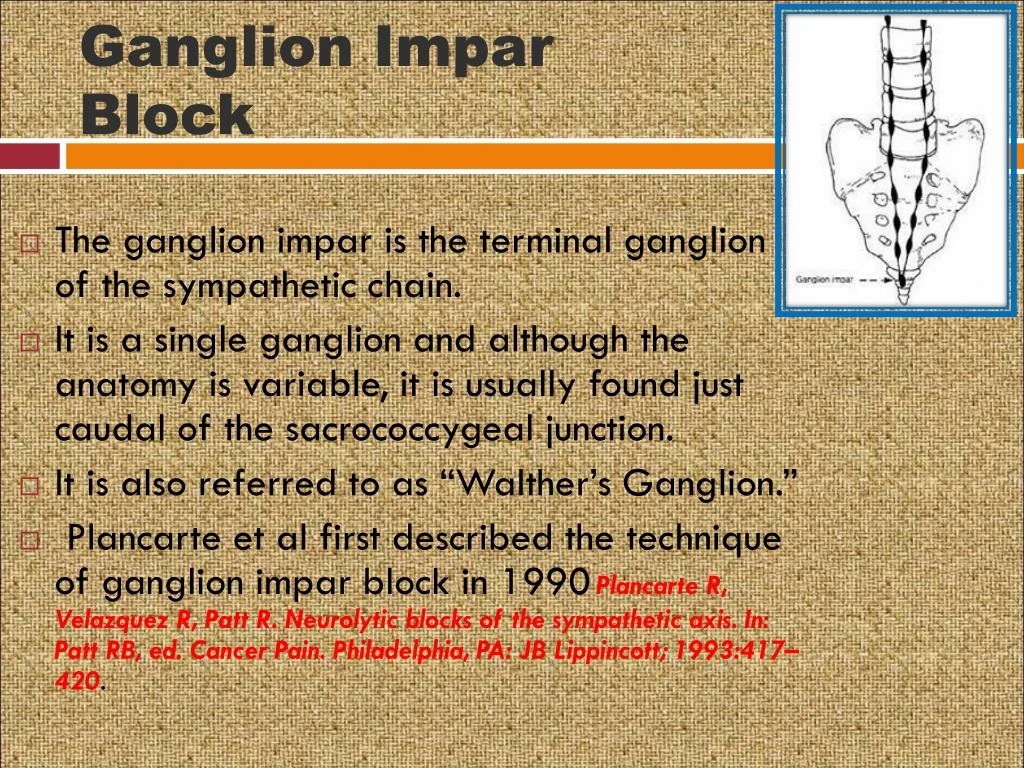 PPT - Ganglion Impar Block PowerPoint Presentation - ID:7376893