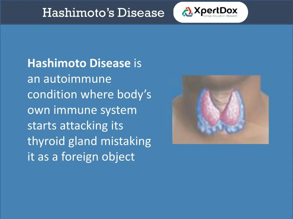 PPT - Hashimotos disease PowerPoint Presentation, free download - ID ...