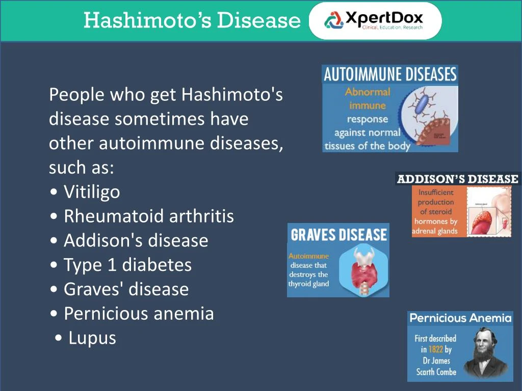 PPT - Hashimotos disease PowerPoint Presentation - ID:7396295