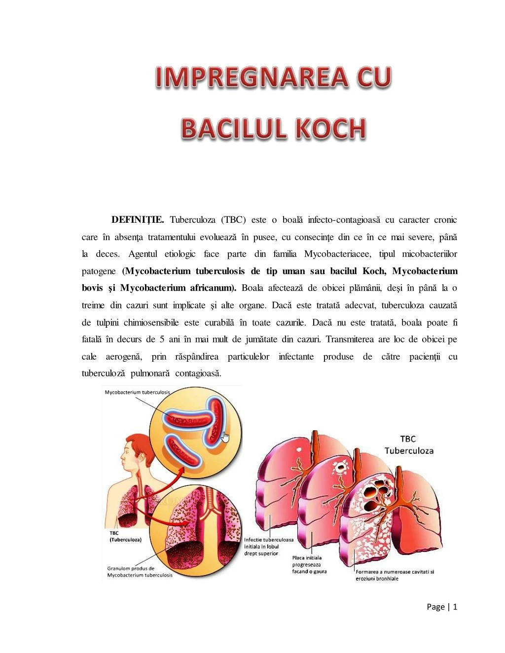 PPT - TUBERCULOZA PowerPoint Presentation, free download - ID:7411600