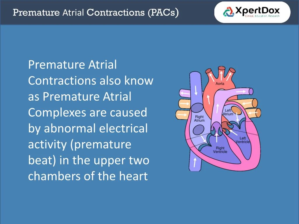 PPT - PAC PowerPoint Presentation, free download - ID:7417357