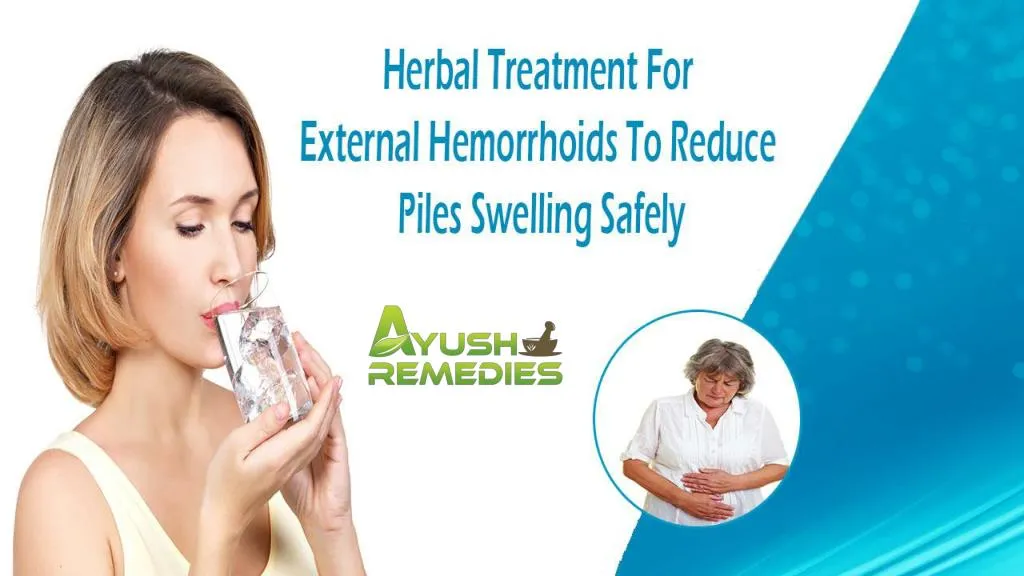 PPT - Herbal Treatment For External Hemorrhoids To Reduce Piles ...