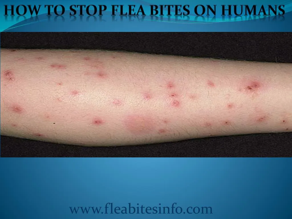 PPT - Flea bites-indication,Infestation treatment PowerPoint ...