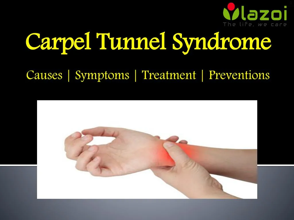 PPT - Carpal Tunnel Syndrome: Causes, Symptoms and Treatment. PowerPoint Presentation - ID:7471006