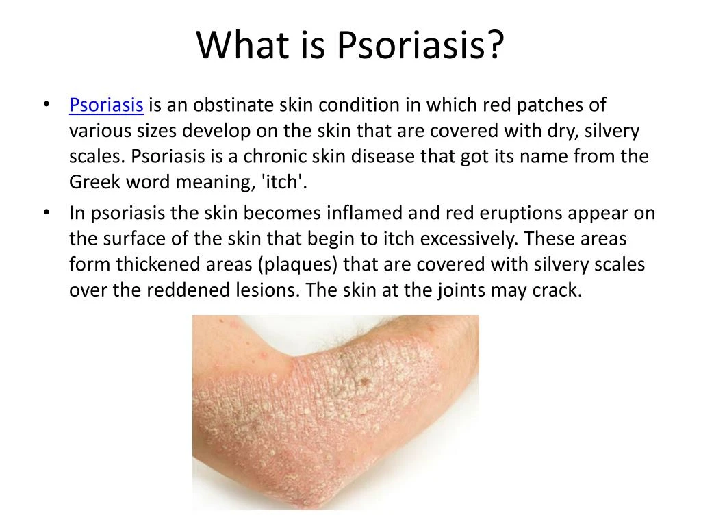 PPT - Top 4 Skin Diseases You Need To Know PowerPoint Presentation - ID ...