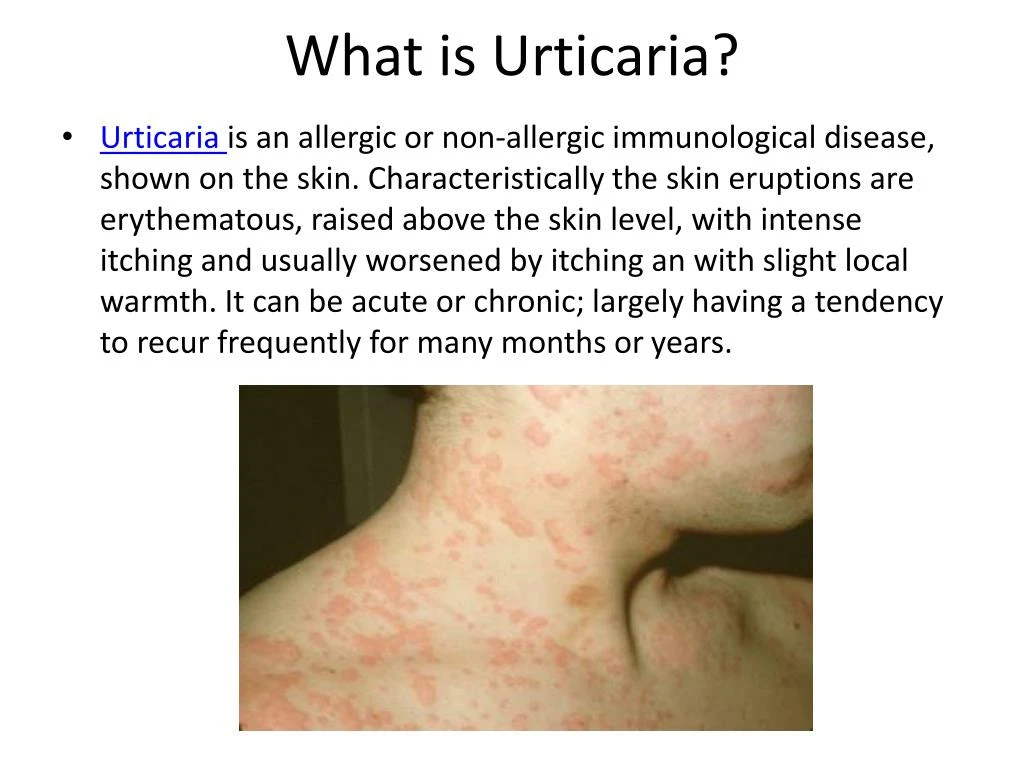 PPT - Top 4 Skin Diseases You Need To Know PowerPoint Presentation - ID ...